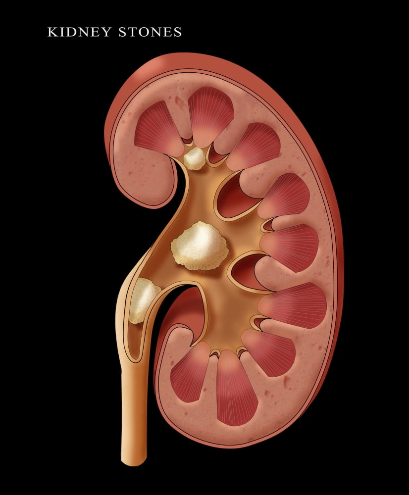 Renal Pelvis