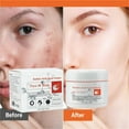 Replenishing Moisturizing 30g EVER SKIN Personal Skin Care 2PCS ...