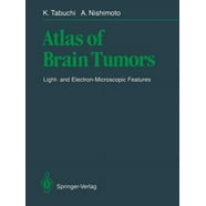 Atlas of Cerebrospinal Fluid Cells (Paperback) - Walmart.com