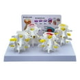 Human Skeleton Model Lumbar Vertebrae Anatomy Model 4-Stage Lesions Comparative Model Teaching ...
