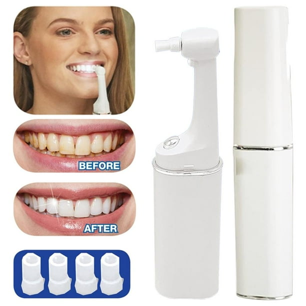 stanreset Electric Tooth Polisher with LED Light Stain Plaque Remover ...