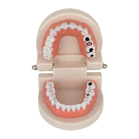 Teaching Model Education Brushing Tooth Model for Preschool Toddlers ...