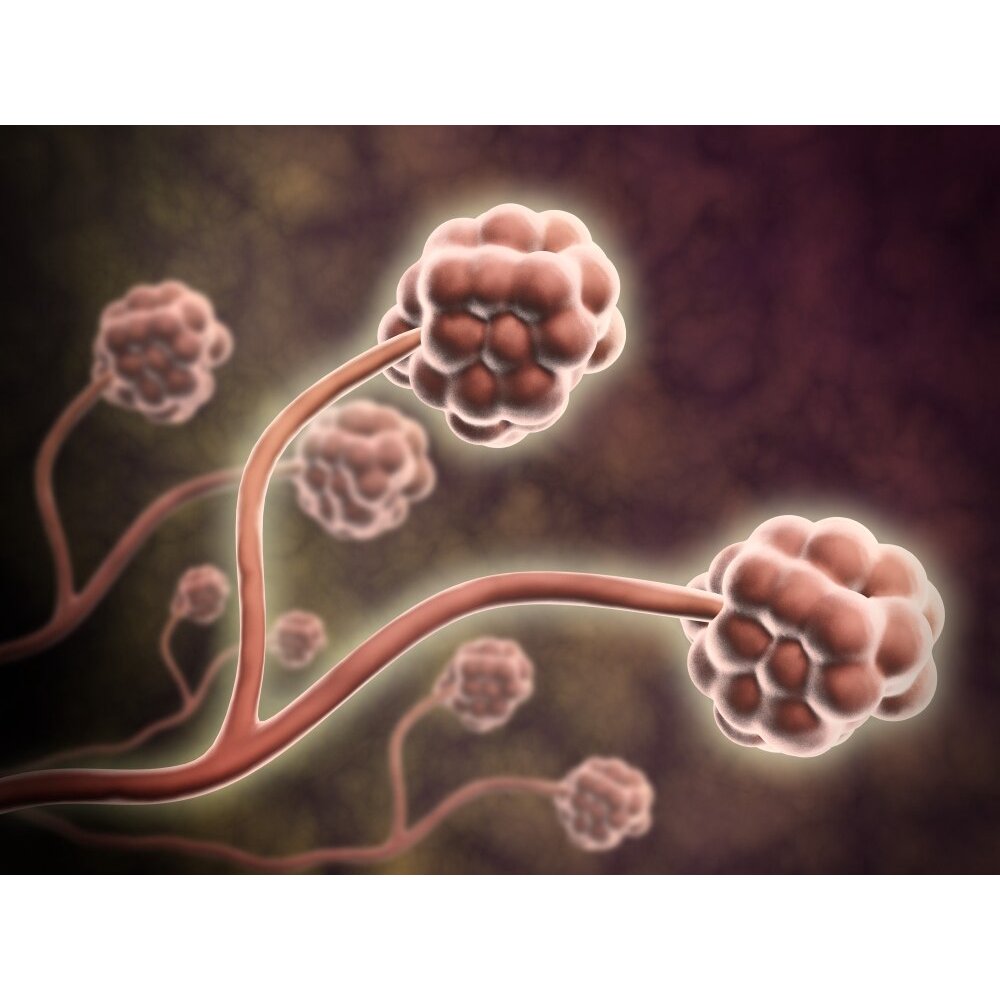 Microscopic view of Stachybotrys chartarum, a black mold Poster Print ...