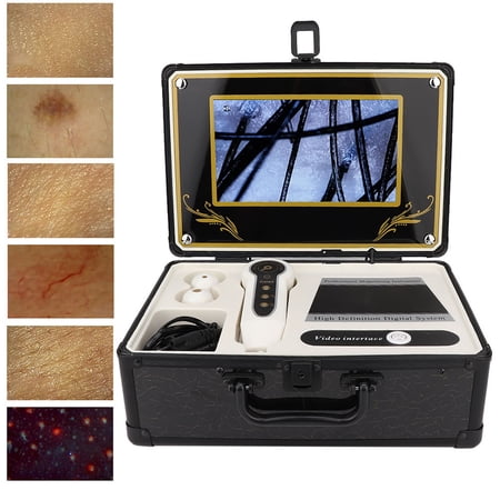 Hair Scalp Detector, Skin Camera, Beauty Salon Skin Care Tool Hair ...