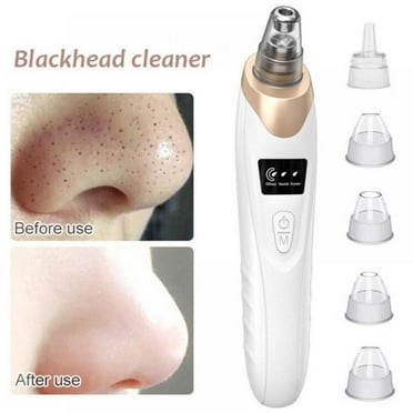 Blackhead Remover Pore Vacuum Cleaner, KROV Electric Rechargeable ...