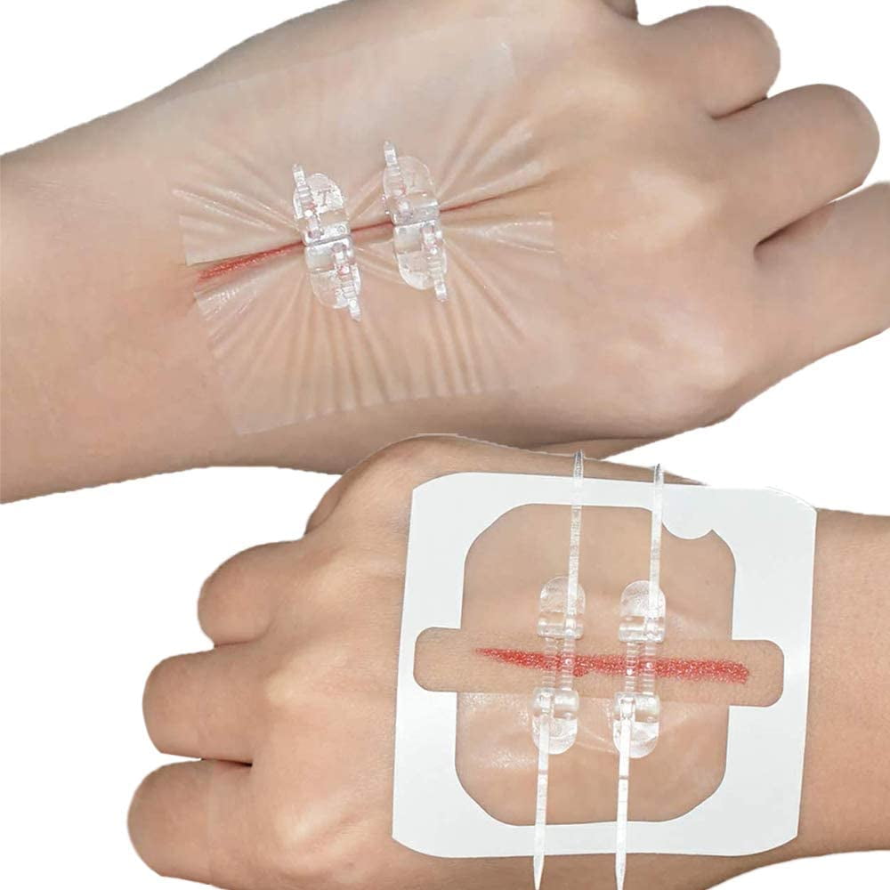 Zip Stitch Sutures X Inches, Zipstitch Laceration Closures Kit Bandages ...