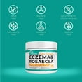 Dermveda Eczema and Rosacea Natural Cream, Soothes Redness, Itchy Scalp ...