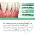 LIANGP Beauty Products 5packs Gum Drops Gum Recession Tooth And Gum Oil ... LIANGP Beauty Products 5packs Gum Drops Gum Recession Tooth And Gum Oil ...