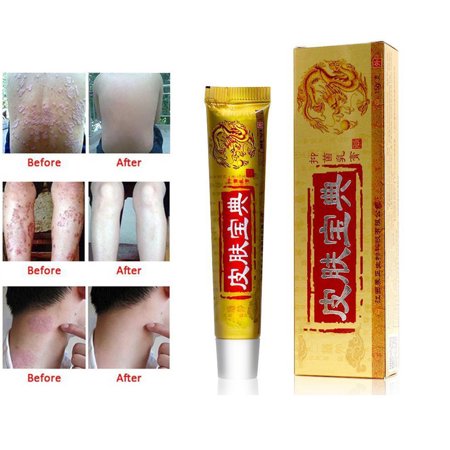 Skin Ointment Chinese Medicine Cream Chinese Medicine Cream Psoriasis ...