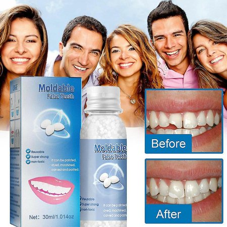 Tooth Repair Kit False Teeth Gaps Replacement Temporary Tooth Filling ...