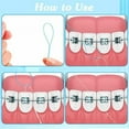 600 Pcs Dental Floss Threader for Bridges, Braces, and Implants Dental ...