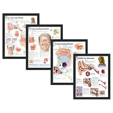 Set of 4 Framed Medical Posters Ear, Nose and Throat, Understanding ...