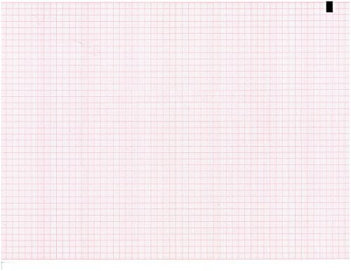 ECG Paper 210MM X 300MM X 250Sheet (Works for Phillips/Honeywell Stress ...