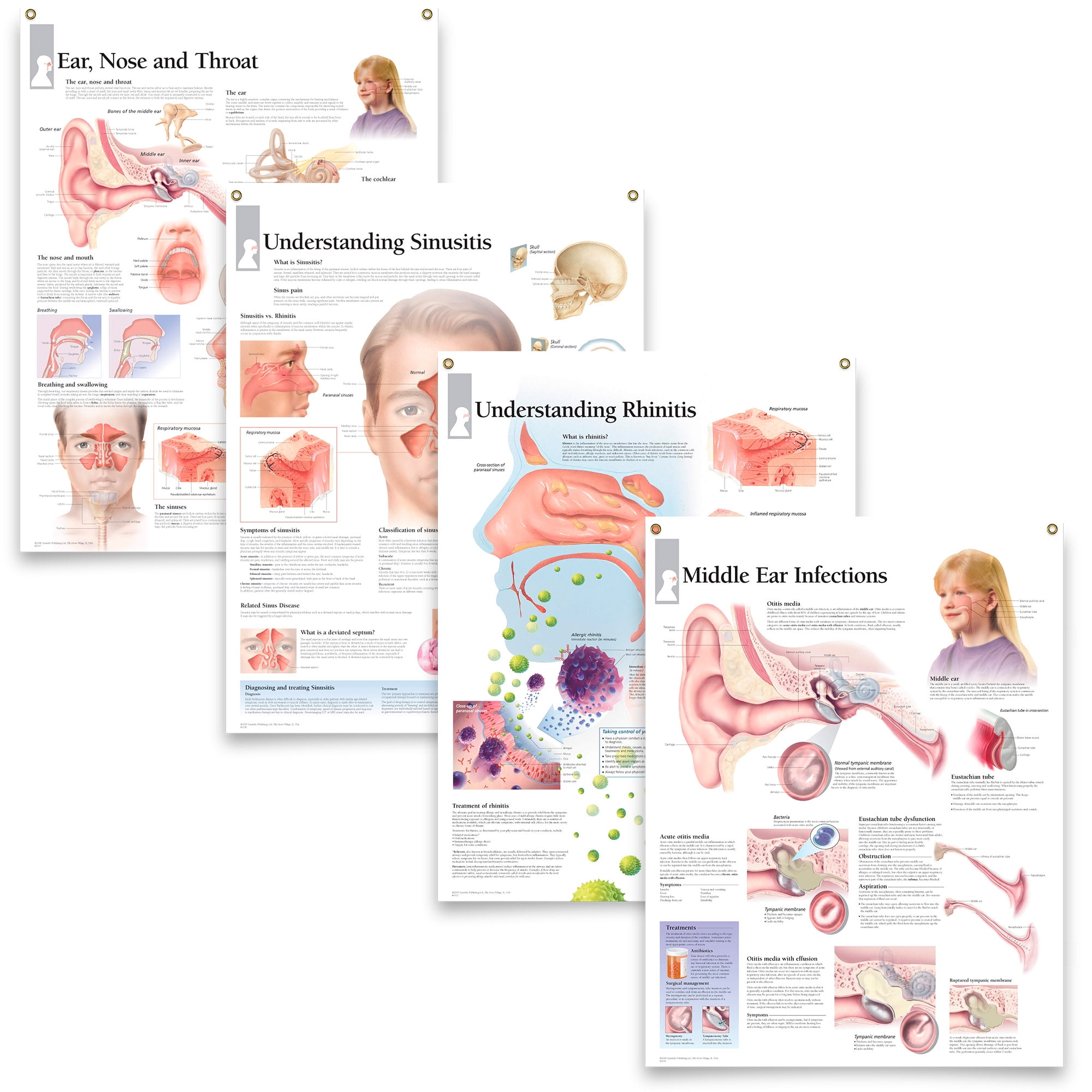 Allergic Rhinitis Poster