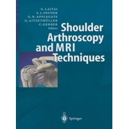 Radiology of the Spine Trauma of the Spine: CT and MRI, (Paperback ...