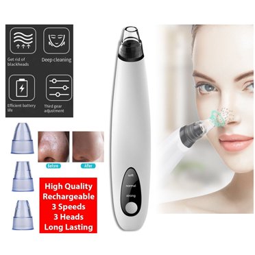 Blackhead Remover Pore Vacuum Cleaner, KROV Electric Rechargeable ...