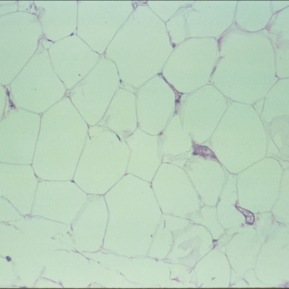 Human Adipose Tissue Slide, 7 M, H&E - Walmart.com