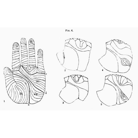 Galton: Hand Diagram./Nsir Francis Galton'S System Of Ridges, And The ...