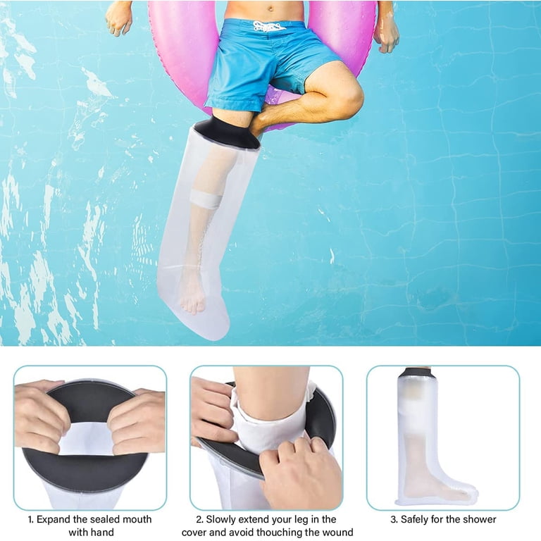 Broken Knee Cast