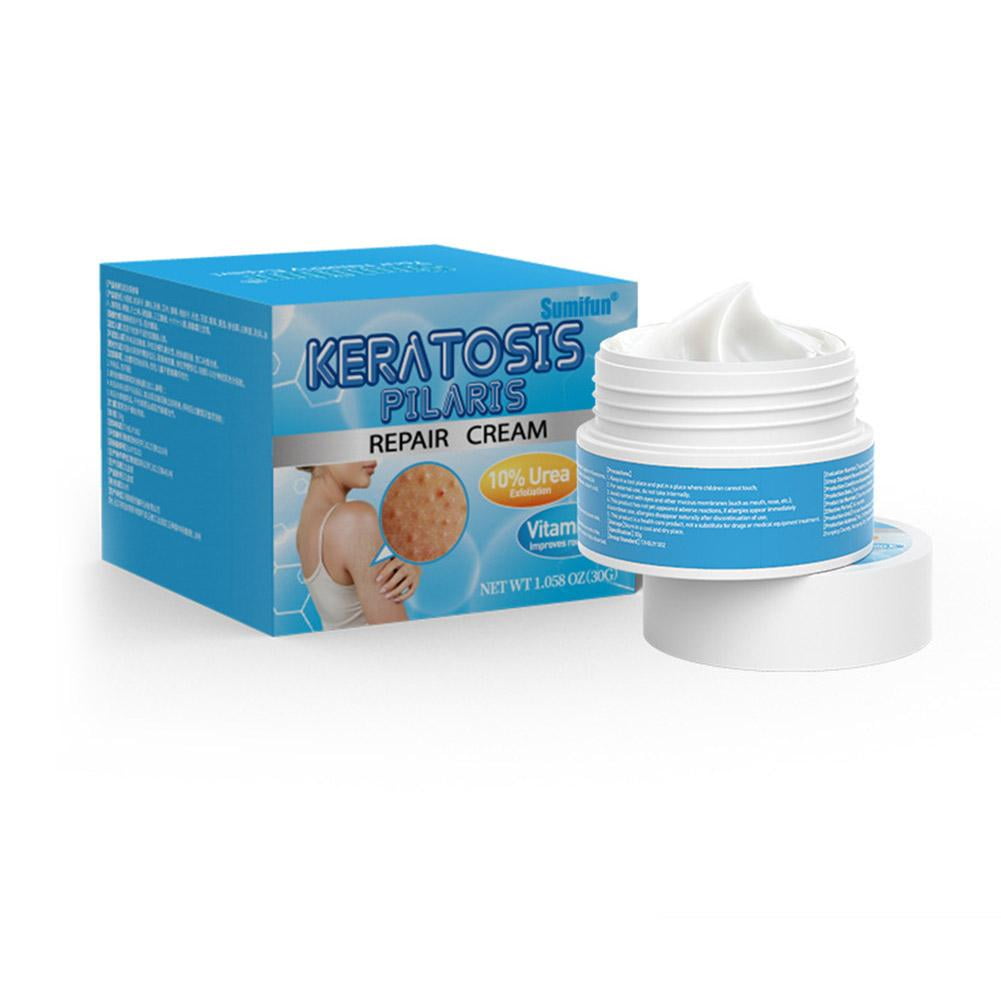 Salicylic Acid Urea Foot Cream Chicken Skin Removal Skin Moisturizer ...