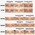 LIDS BY DESIGN Assortment Pack (4mm - 7mm) Eyelid Correcting Strips for ...