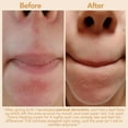Thena 25 In 1 Healing Moisturizing Cream Dry Irritated Itchy Skin Care For Eczema Psoriasis 45