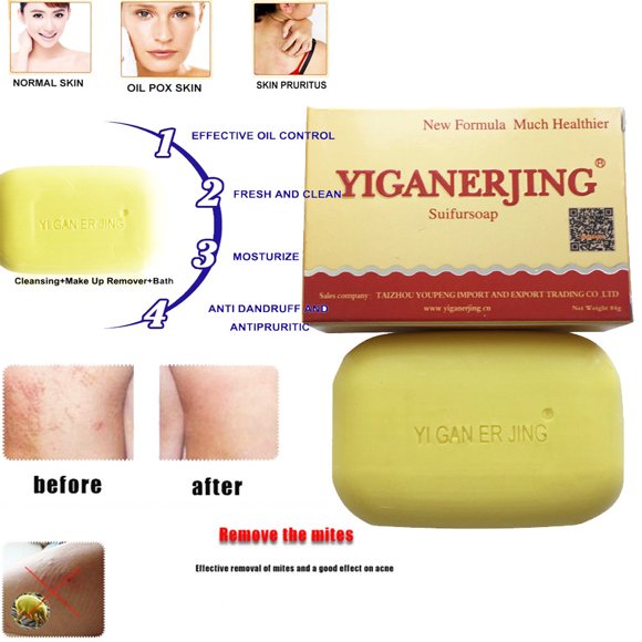 Soap Tinea Versicolor