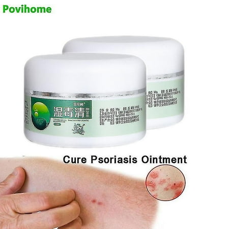 30g Eczema Psoriasis Antibacterial Treatment Ointment Dermatitis Eczema ...