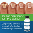 Funginix Healthy Nail Formula - Clinically Proven Anti-Fungal Medicine ...