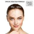 Dead Sea Collection Day And Night Cream Kit With Vitamin C Anti Aging