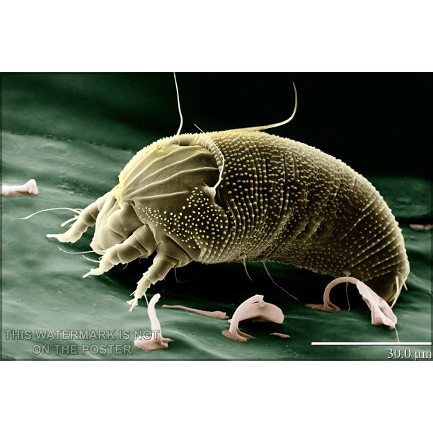 24"x36" Gallery Poster, mite scanning electron microscope - Walmart.com