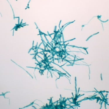 Spider Prepared Microscope Slide, Whole-Mount - Walmart.com