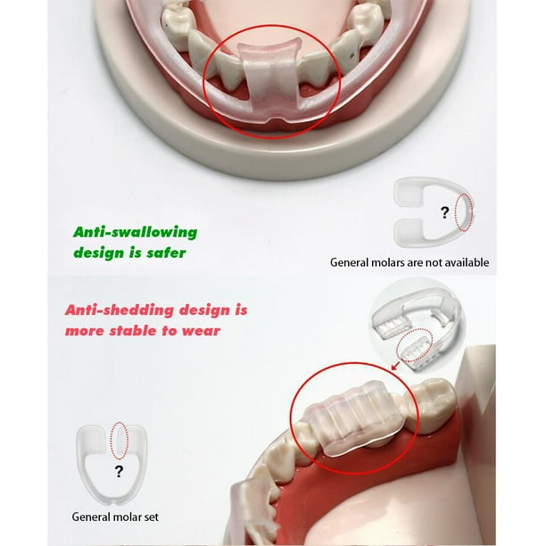 Protector dental nocturno profesional que evita el bruxismo y el ...
