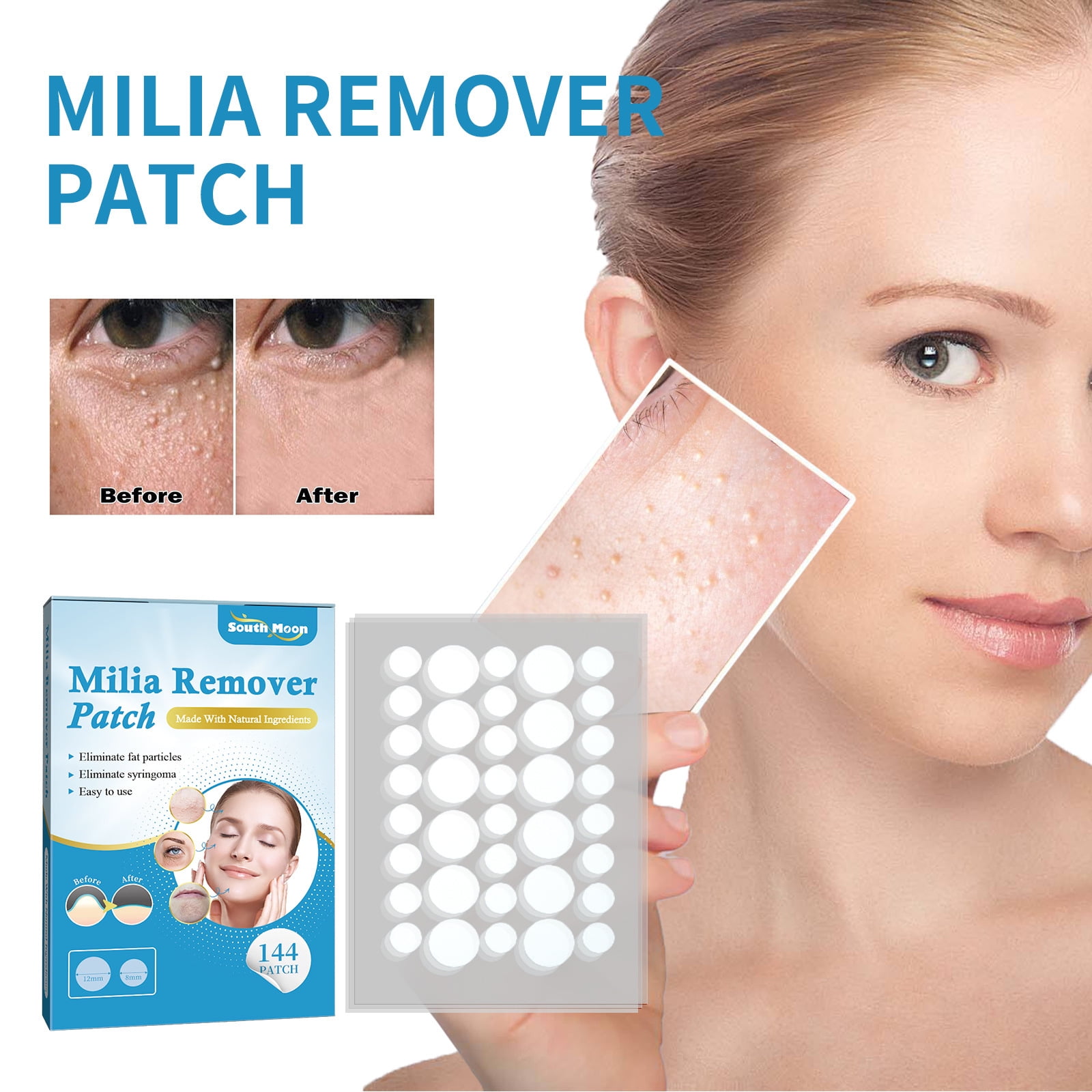 White Bumps On Face Not Milia Lupon gov ph white-bumps-on-face-not-milia-lupon-gov-ph