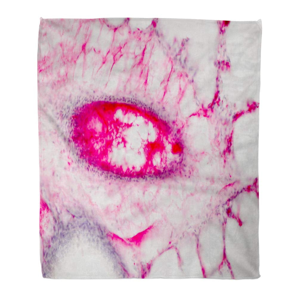 ASHLEIGH Throw Blanket Warm Cozy Print Flannel Human Lung Tissue Under ...