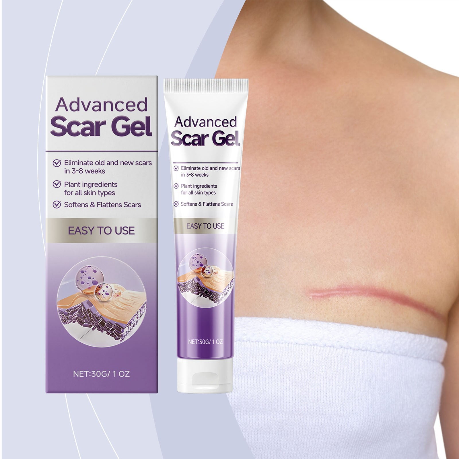 A Mild Formulation Of Scar Gel Stimulates Collagen Production To Reduce ...