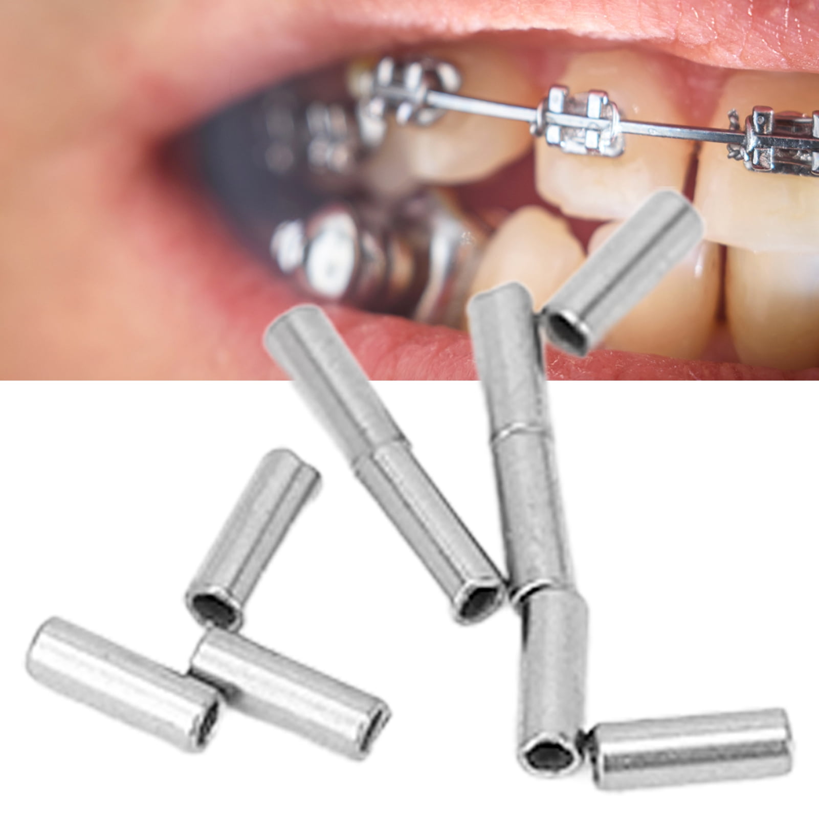 Tope De Soporte De Ortodoncia Dental, Mini Topes Dentales Prensables De ...