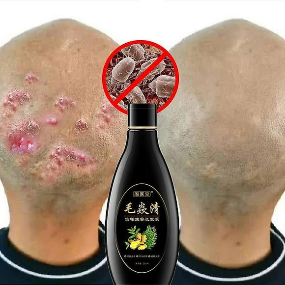 Anti Antibacterial Shampoo