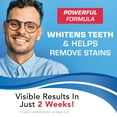 Plus White Xtra Whitening Toothpaste - Dental Whitener, Anti-Cavity ...