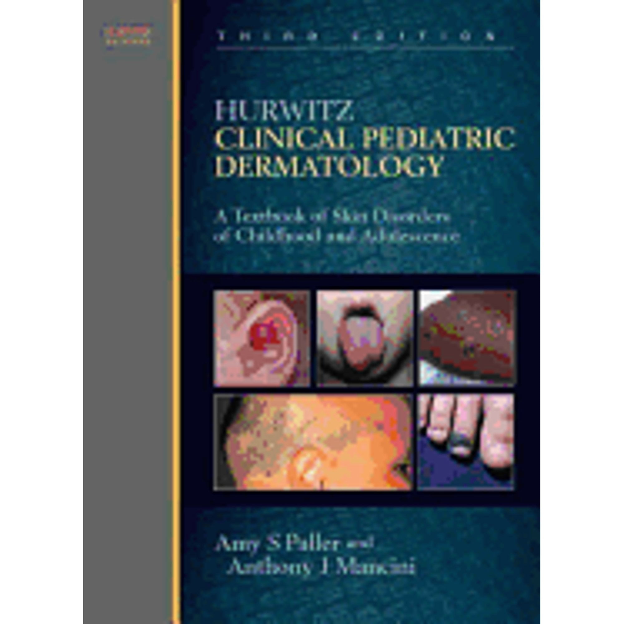 Hurwitz Clinical Pediatric Dermatology: A Textbook of Skin Disorders of ...