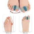 XIRQI 2Pcs Toe Separator Orthopedic Bunion Valgus Hammertoe Corrector Natural Realignment Women ...