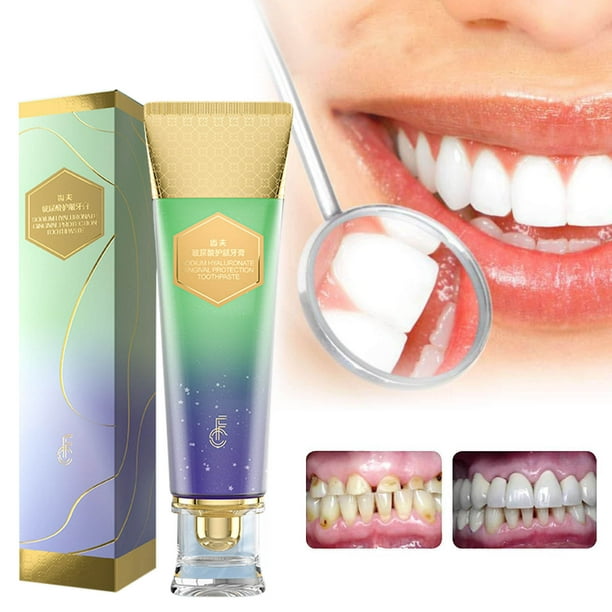Cotonie Nicotinamide Whitening Toothpaste Cleaning Fresh Breath Bright ...