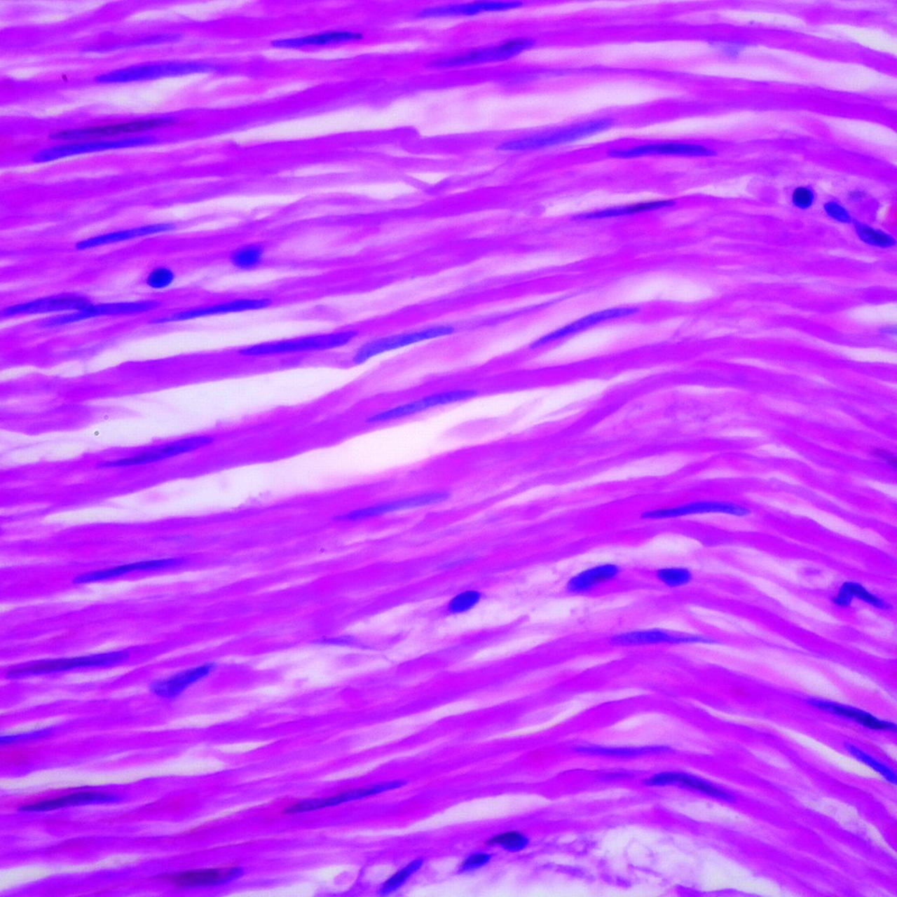 Human Smooth Muscle - Intestine, L.S. 7 M H&E Microscope Slide ...