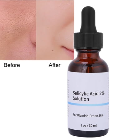 Face Serum, Liquid Texture Moisturizing Serum, Rich In Salicylic Acid ...