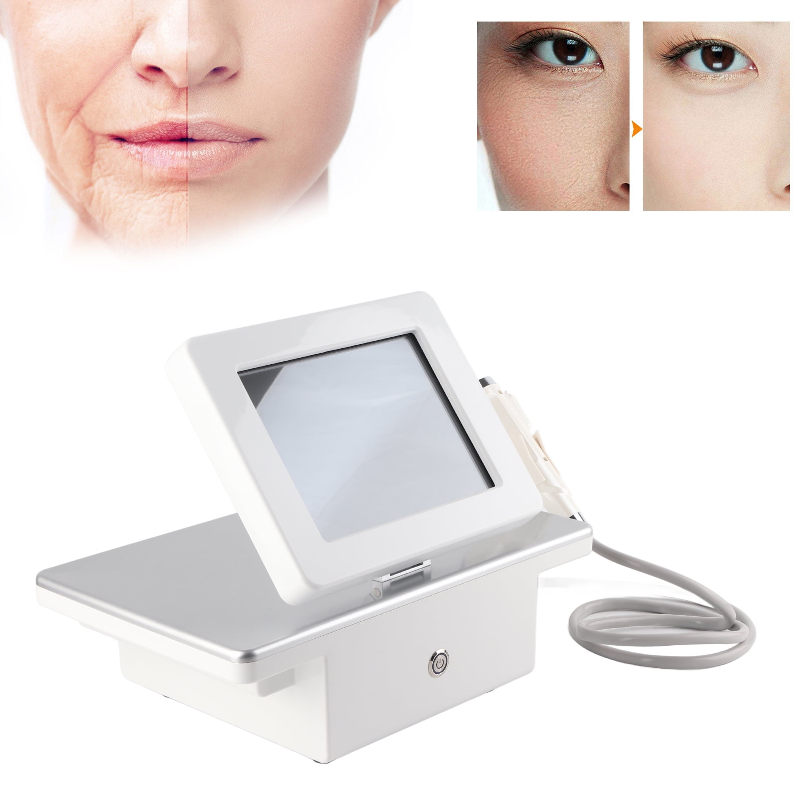 Skin Firming Device, Swelling Reduce Whitening RF Skin Lifting Machine ...