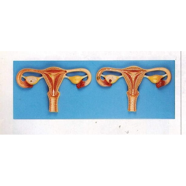 Wellden Medical Anatomical Fertilization Process Model - Walmart.com