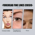 Sumllary Forehead Patch Moisturizing Hydrating Smoothing And Firming Forehead And Frown Lines