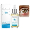 OCuSOFT Hypochlor Medical Eyelid Spray, 0.02% Hypochlorous Acid ...