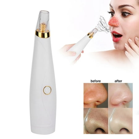 Garosa Face Blackhead Removal, Electric Blackhead Removal Beauty ...
