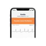 AliveCor, KardiaMobile 6L EKG Heart Monitor, 6-Lead medical grade EKG ...